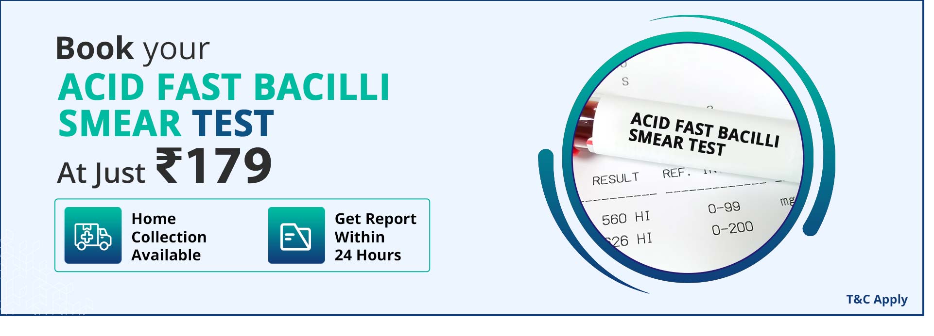 Acid Fast Bacilli Smear Test Old Slum Quarters | Acid Fast Bacilli ...